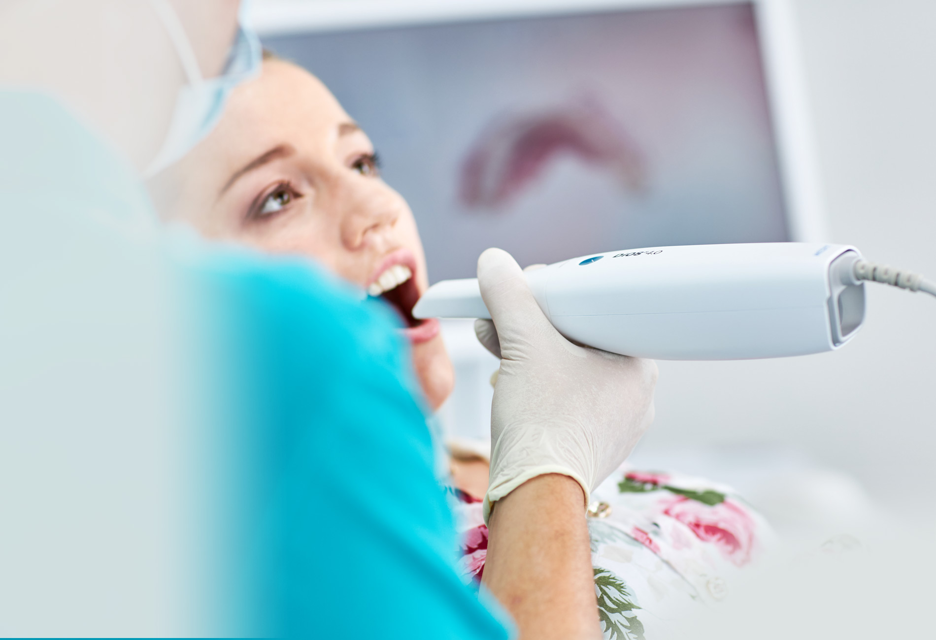 Intraoralscanner Zahnarzt - digitaler Abdruck (Intraoralscan)